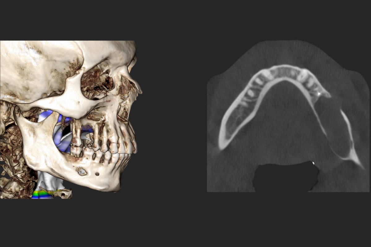 Consultation Services - Inspire Imaging